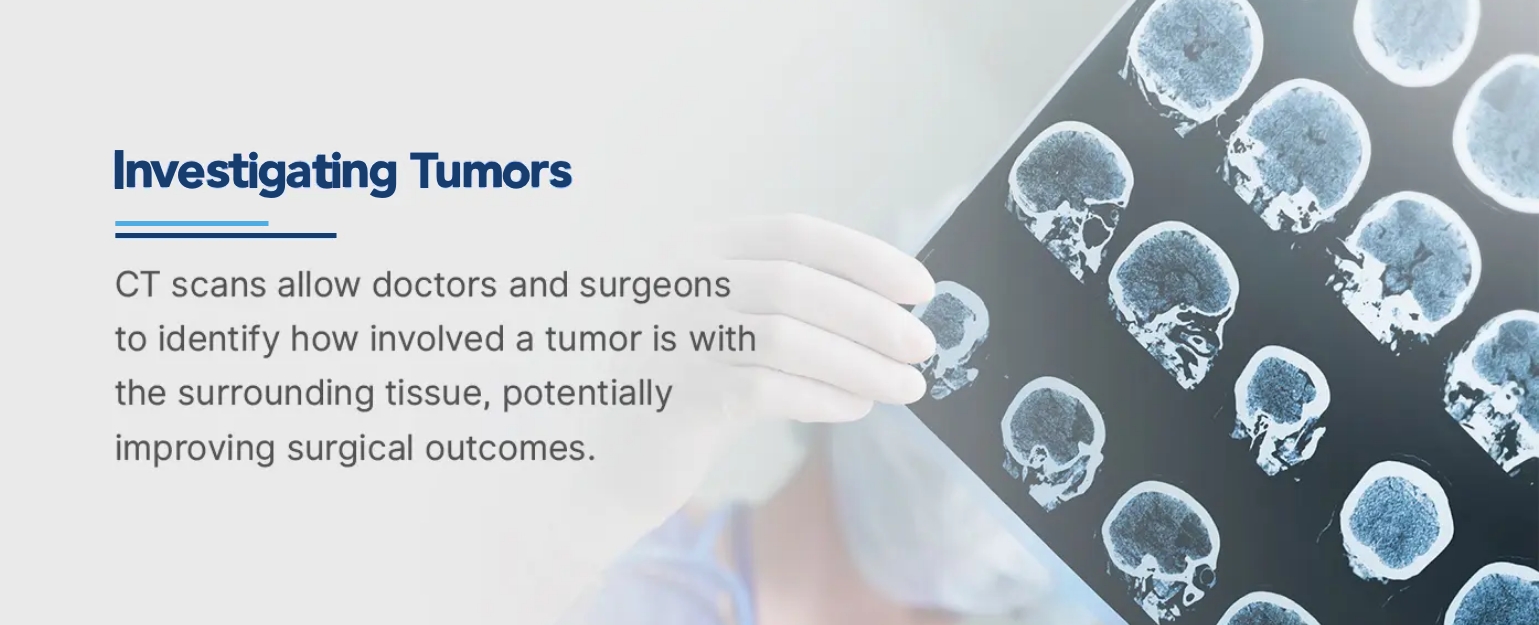 Reasons Why You May Need a CT Scan - Clear Connect